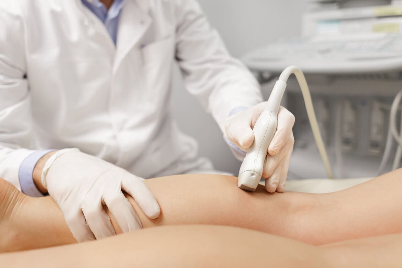 The Benefits of Sclerotherapy - Vein Institute
